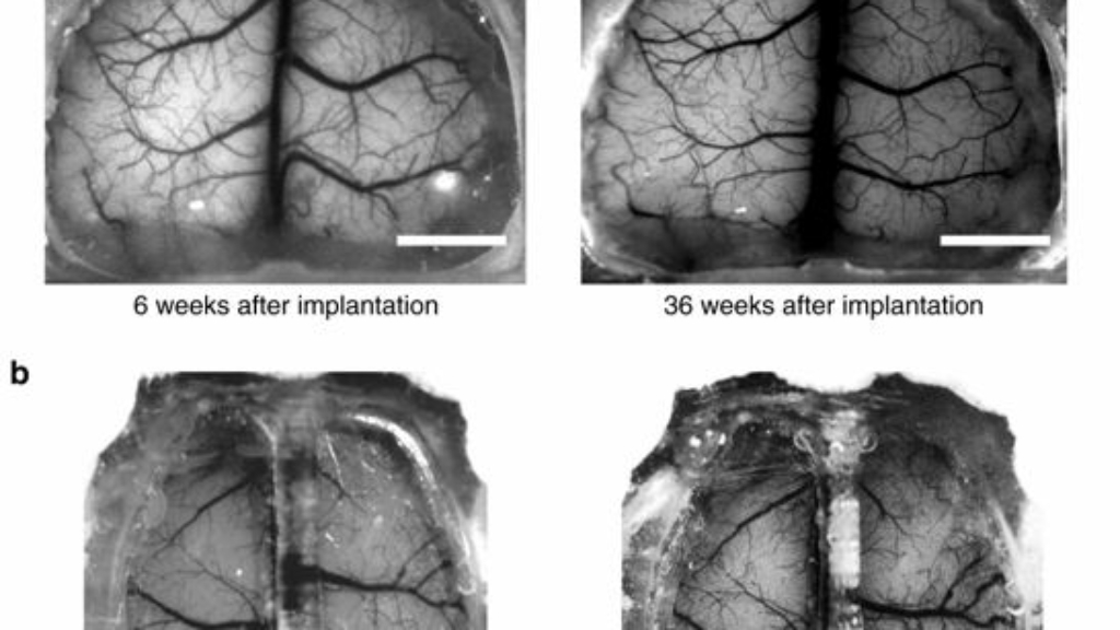 University of Minnesota Develops Transparent Skull for Mice Using 3D ...