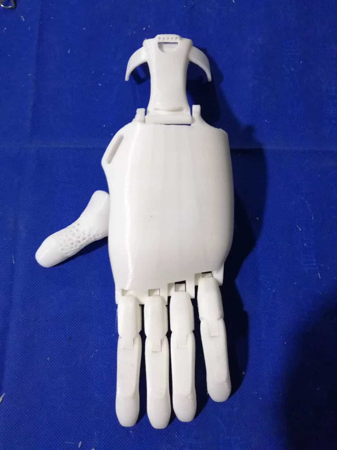 FDM 3D Printed Hand Prosthesis For Disabled People - FacFox