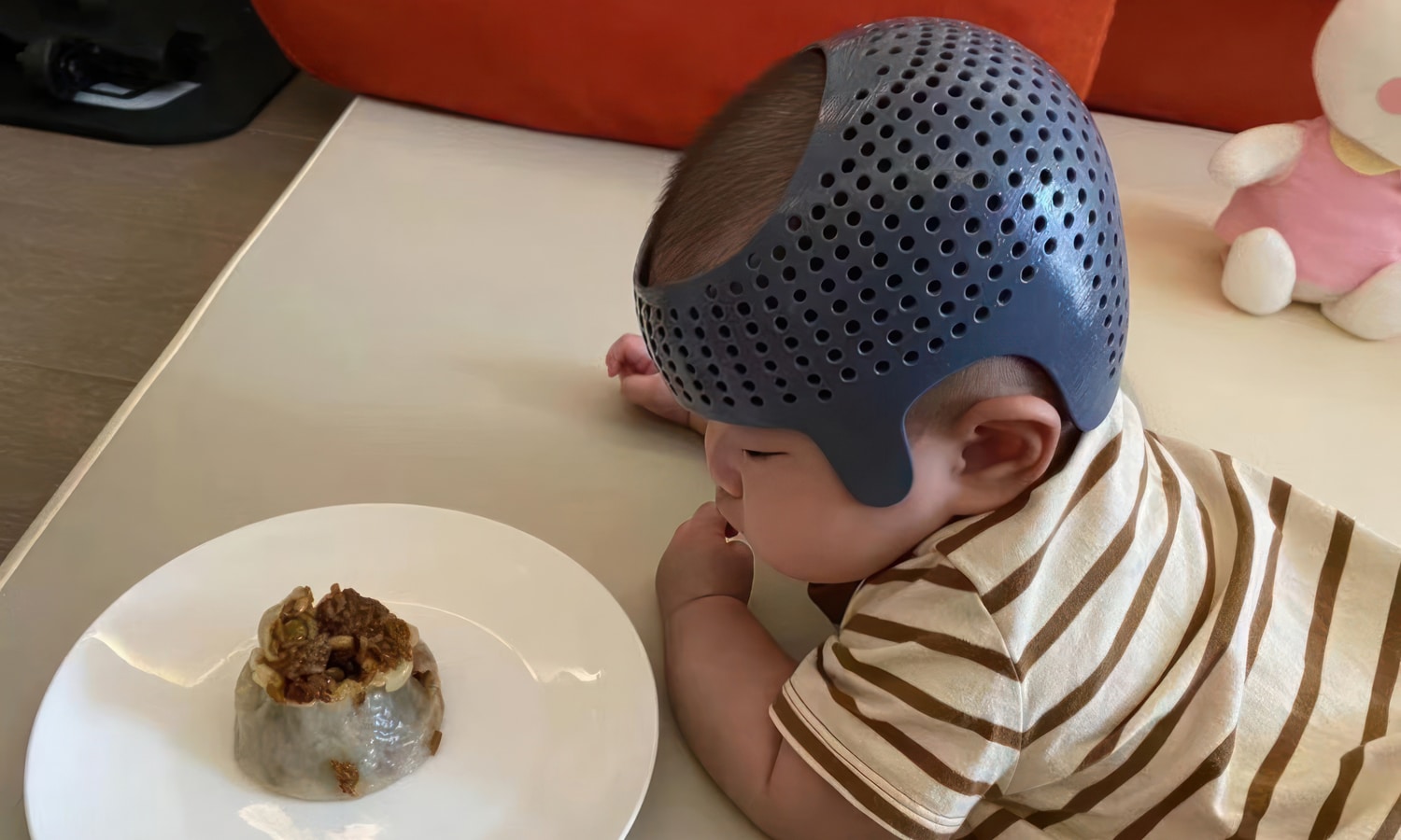 FDM 3D Printed PLA Infant Cranial Remodeling Helmet