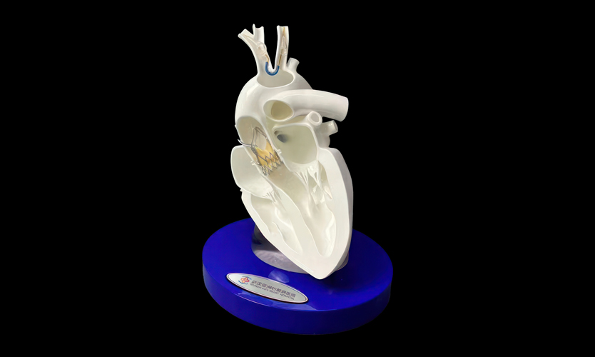 SLA 3D Printed Anatomical Heart Model for PCI Treatment
